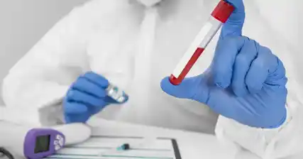 Entendendo os resultados do teste de HIV: o que eles significam?