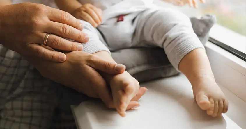 Congenital Limb Deformities: What You Need to Know