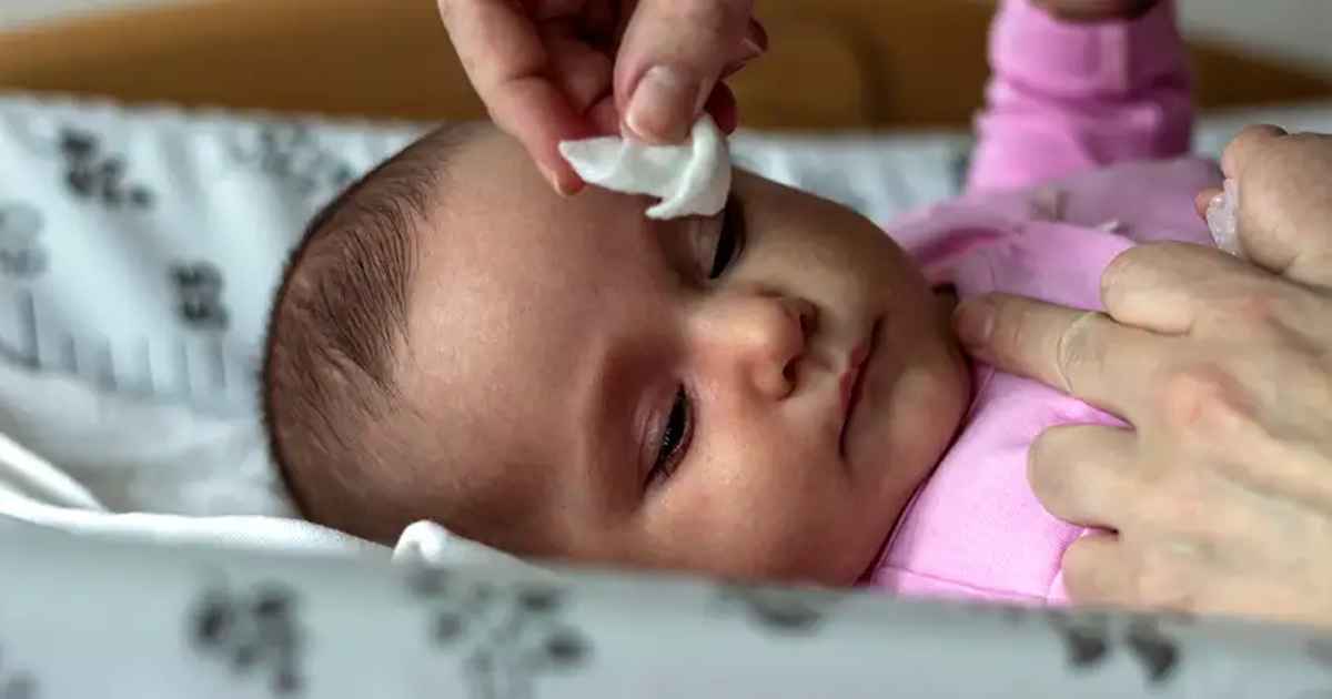 Conjunctivitis in Newborns: Understanding the Different Types
