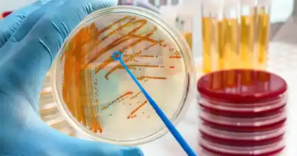 Infeksi Menular Seksual (IMS) dan Kehamilan: Risiko dan Skrining