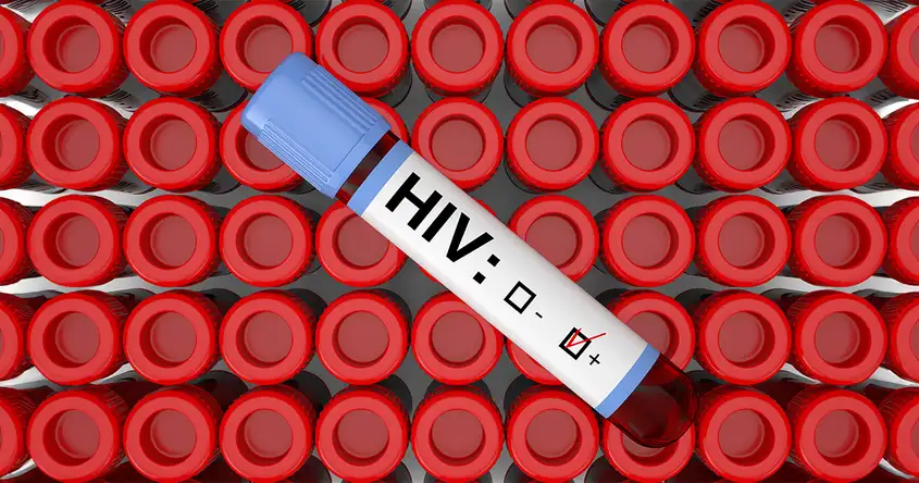 HIV Testing: Confidentiality and Privacy Concerns