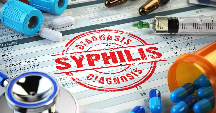 Managing Syphilis: Tips for Preventing Transmission and Recurrence