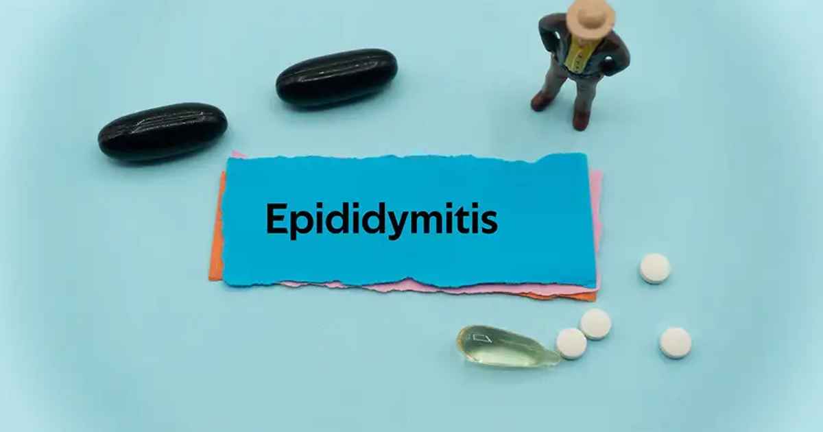 Epididymitis Lump