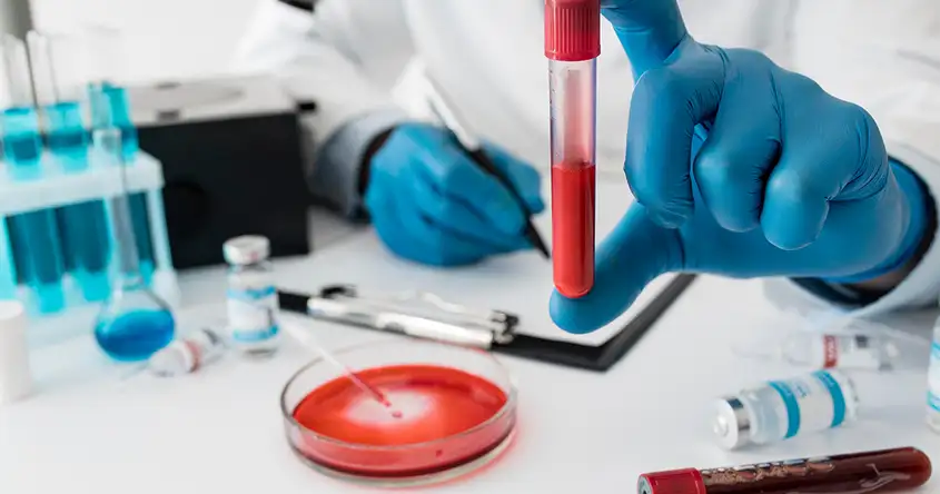 Understanding HIV Testing: Types and Procedures