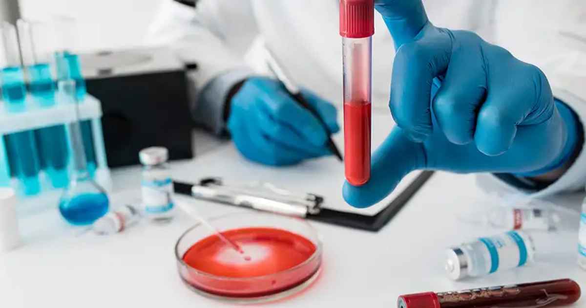 Understanding HIV Testing: Types and Procedures