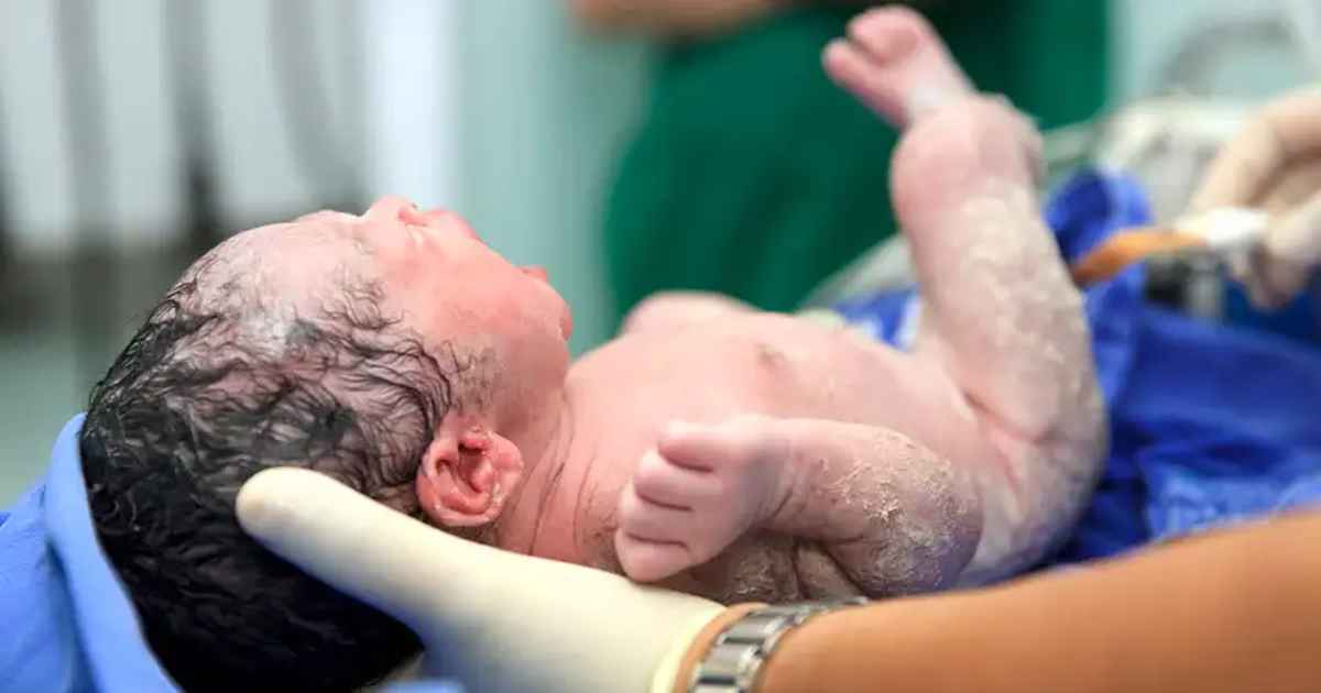 Understanding Large-for-Gestational-Age (LGA) Newborns: Causes and Risks