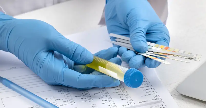 Understanding Semen Parameters: What Are the Normal Ranges?