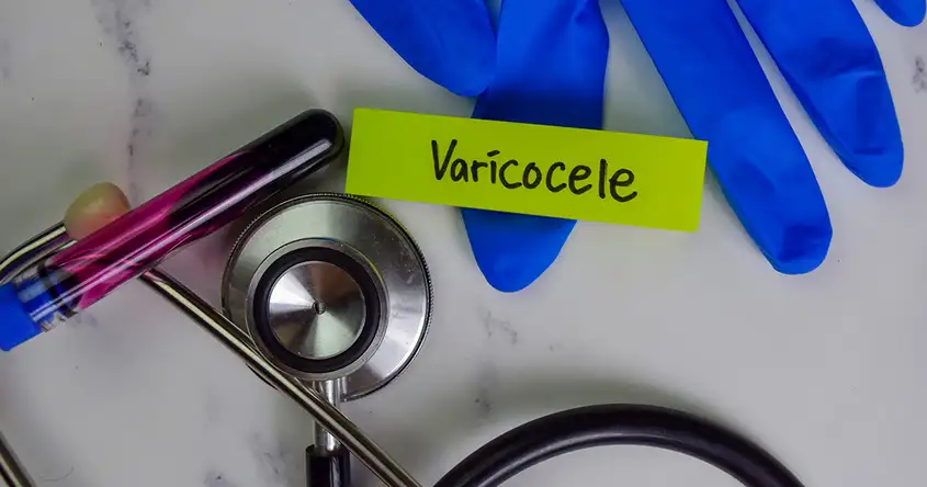 Entendendo a varicocele: causas, sintomas e diagnóstico