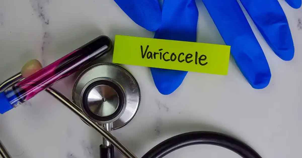Memahami Varikokel: Penyebab, Gejala, dan Diagnosis