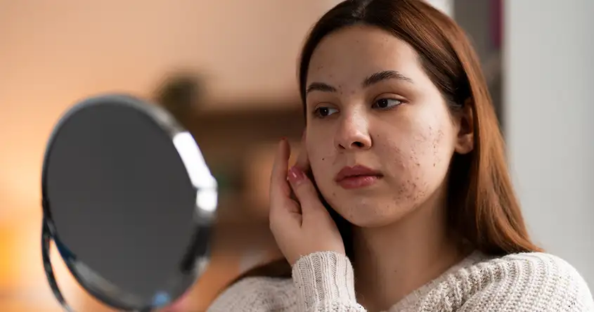 Skin-Pricking Disorder