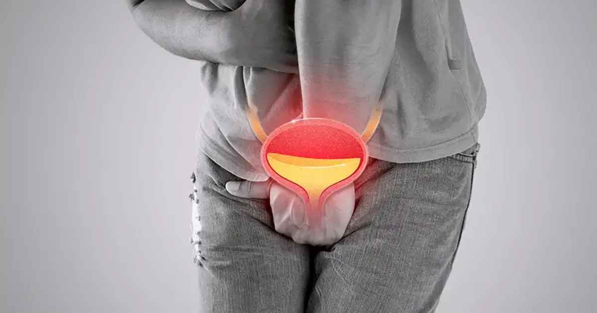 Recurrent Lower Urinary Tract Infection Uti In Men